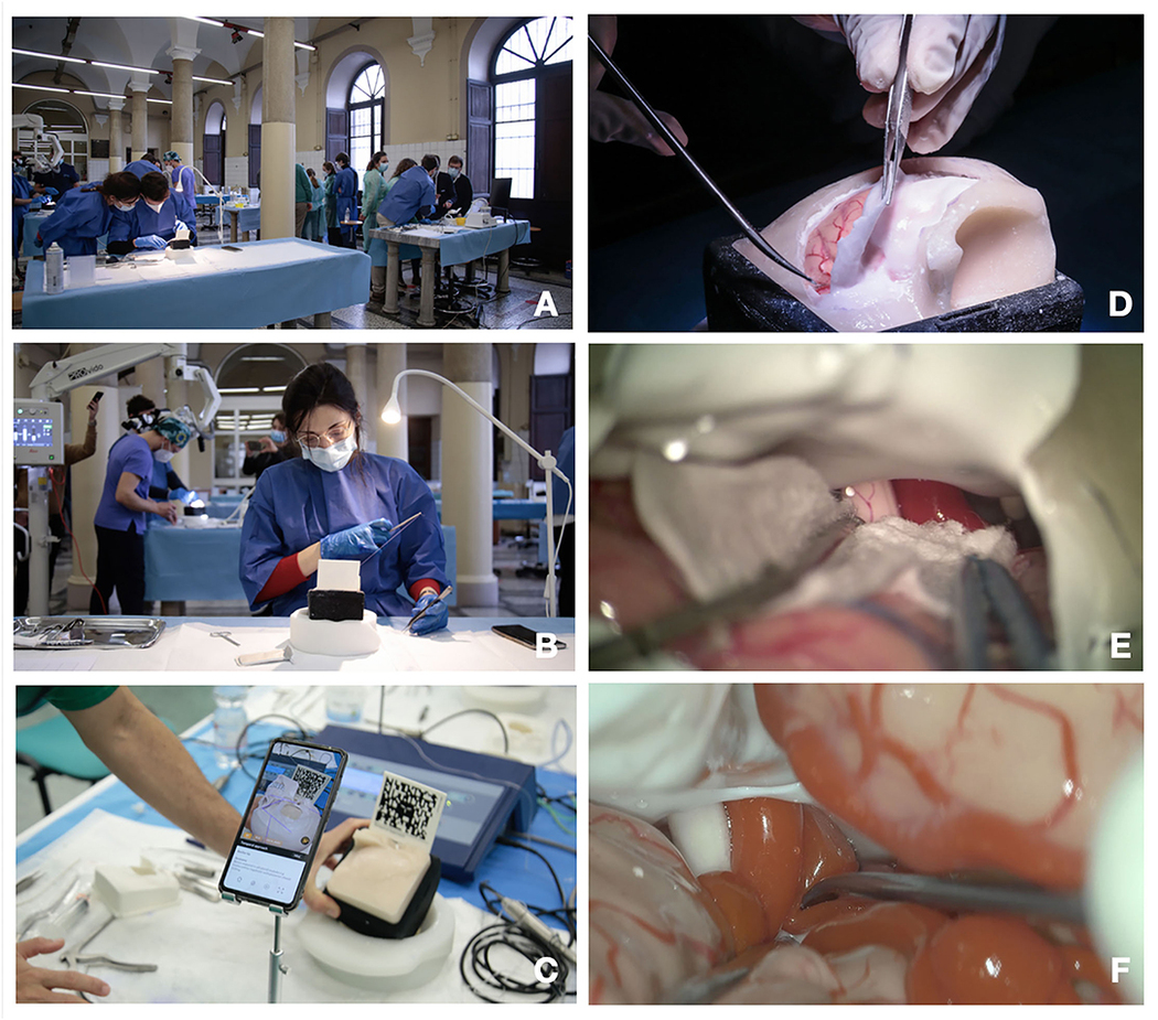 Neurosurgery with virtual & augmented reality